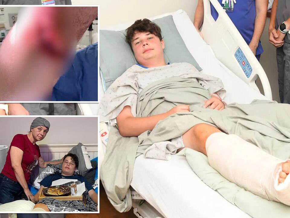 Boy, 14, recalls almost losing leg in NC beach shark horror: ‘I was ...
