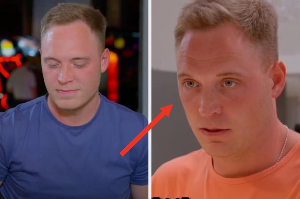 Jimmy From "Love Is Blind" Shared How Much His Hair Transplant Cost ...