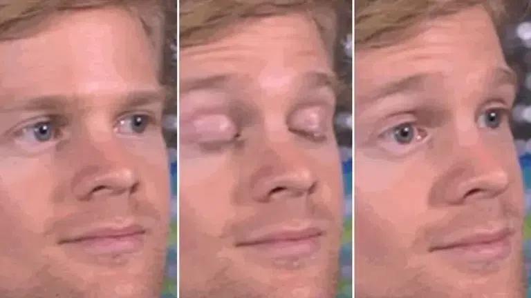 Here’s What the Dude in the ‘Blinking Guy’ Meme Looks Like Now - NewsBreak