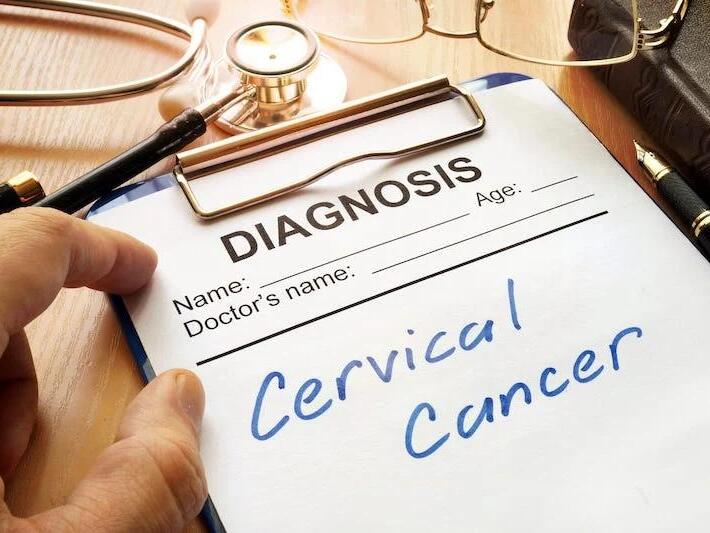 New HPV Self-Testing Method Improves Cervical Cancer Screening