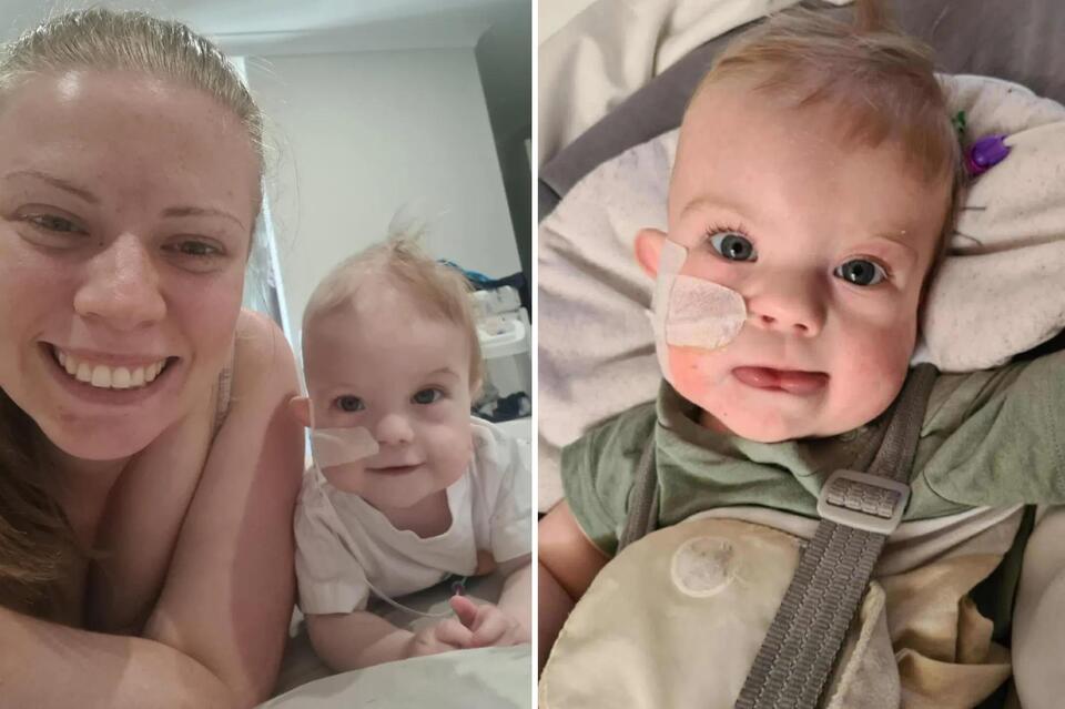 Baby born with rare genetic disorder undergoes eight surgeries in 18 ...