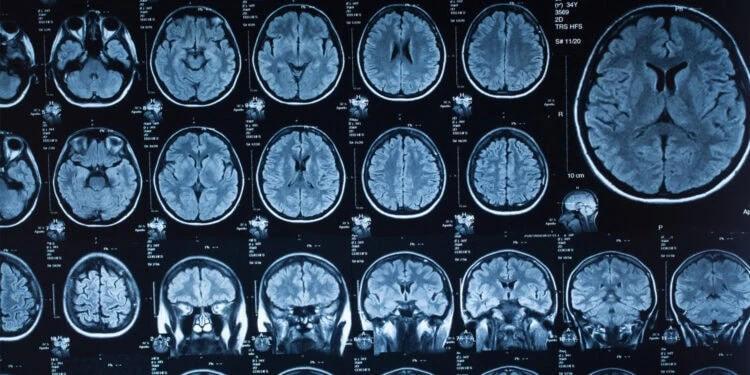 Scientists identify five distinct phases of brain structure across the ...