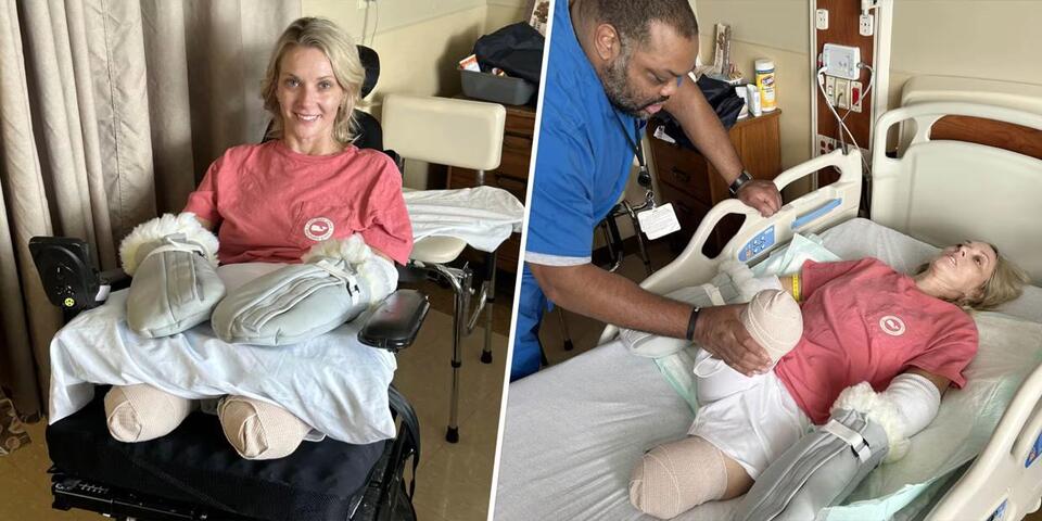 Mom, 41, has legs amputated after kidney stone turns almost deadly ...