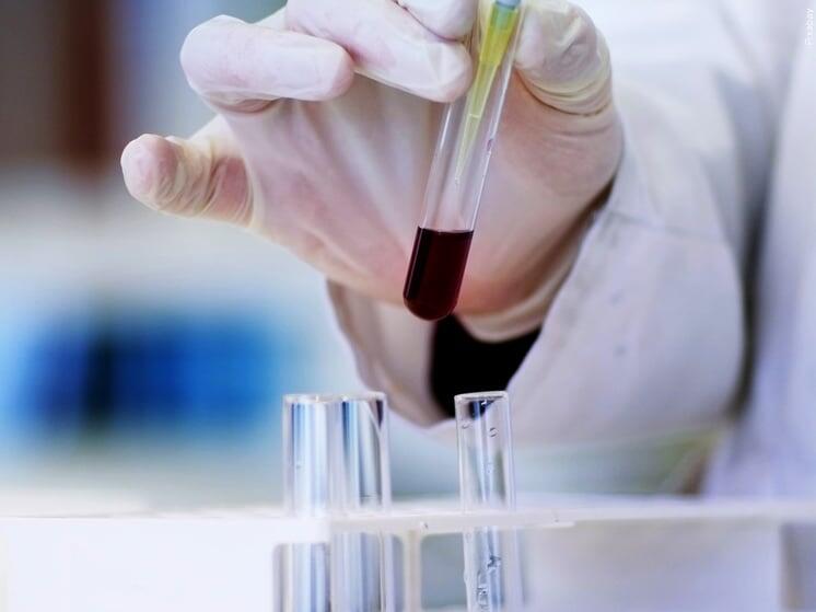 SC DHEC to offer free HIV and STD testing