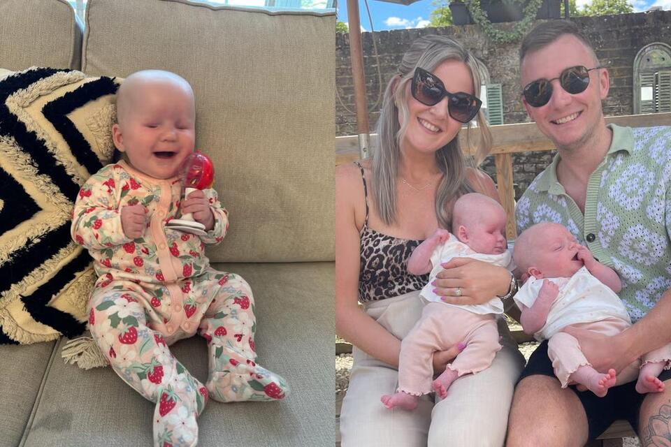Baby born without eyes due to extremely rare condition - NewsBreak