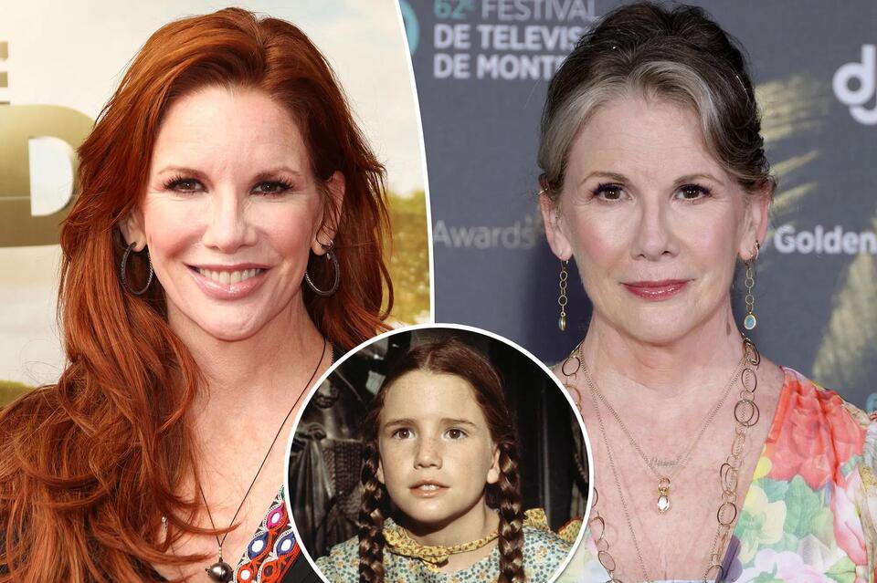 Melissa Gilbert says botched Botox left her looking like ‘spawn of ...