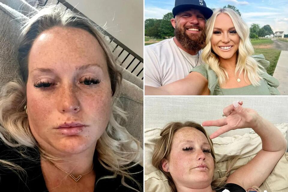 Mom paralyzed after Botox-like injections ‘poisoned’ her body: ‘Worst ...