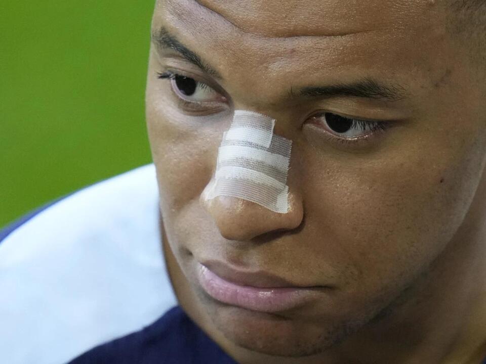 Kylian Mbappé trains at Euro 2024 with bandage on broken nose and ...