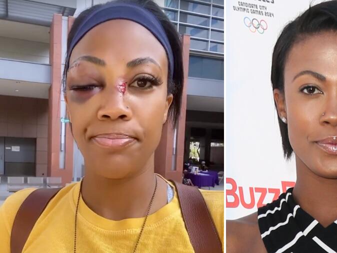 Olympian Kim Glass Nearly Blinded After Being Attacked With A Metal Pipe