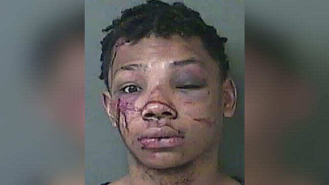 Residents Fight Off Armed 18-Year-Old Who Broke Into Their Apartment ...