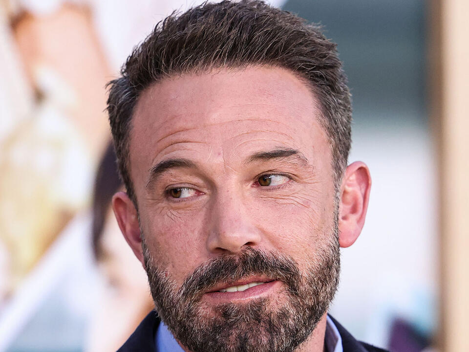 Fans Think Ben Affleck Had Bad 'Plastic Surgery' After His Appearance ...