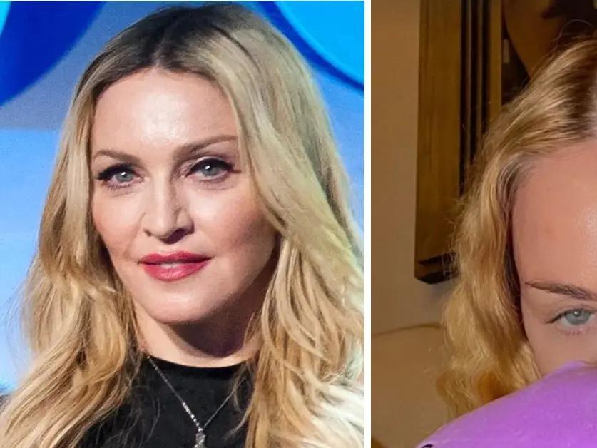 Madonna Looks Healthy in New Photo Weeks After Being 'Brought Back From ...