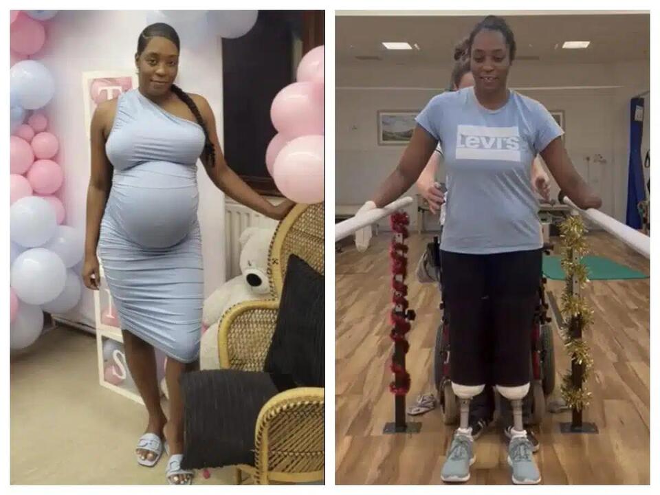How this London mom is thriving after losing her legs, left arm ...