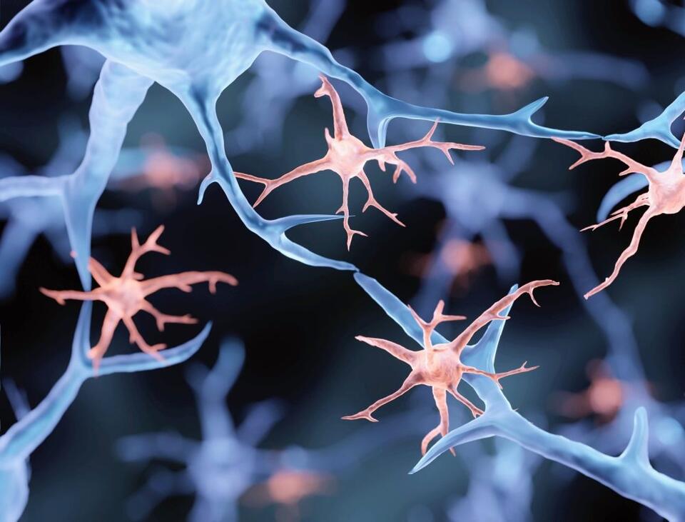 Eating fewer calories helps the aging brain rewire itself - NewsBreak