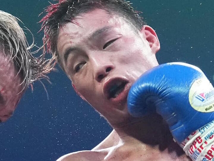 Kazuki Anaguchi Undergoes Emergency Craniotomy, Remains Unconscious ...