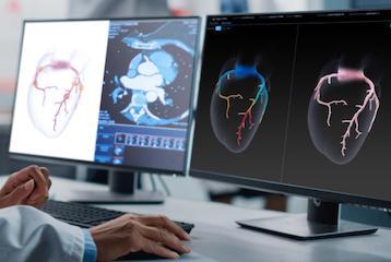 Heartflow Rebrands, Reaffirms Commitment to Improving CAD Care ...