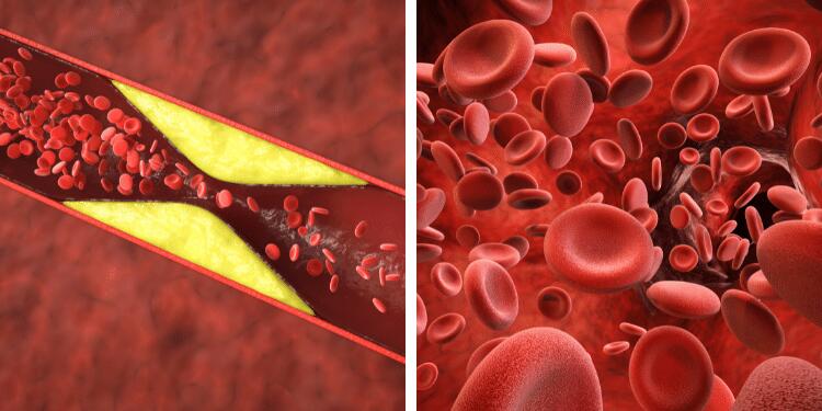 10 Early Warning Signs of a Blood Clot You Should Never Ignore - NewsBreak
