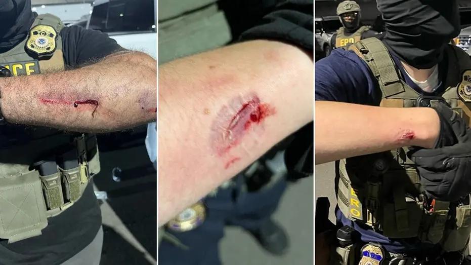 Anti-ICE agitator charged with allegedly biting officers during Delaney ...