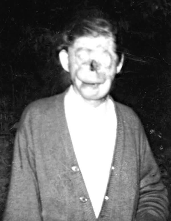 Raymond Robinson: The Real-Life Urban Legend Of ‘Charlie No-Face ...
