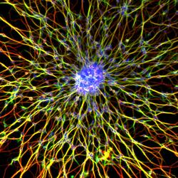 Hybrid Biocomputer Fuses Human Brain Tissue With Computer Chips - NewsBreak