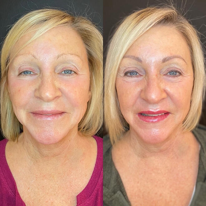 Embrace Your Best Self: The Psychology of Permanent Cosmetic Procedures ...