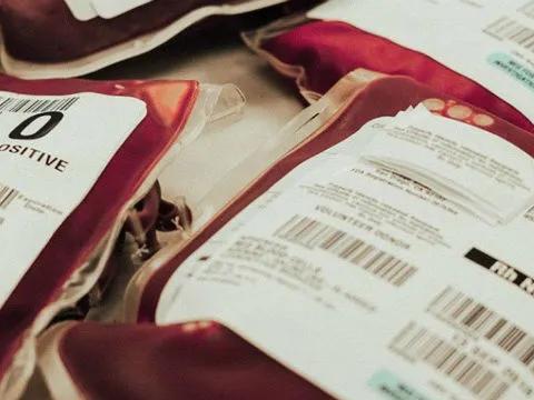 Blood Donors Can Earn SeaWorld Howl-O-Scream Tickets Through SD Blood Bank