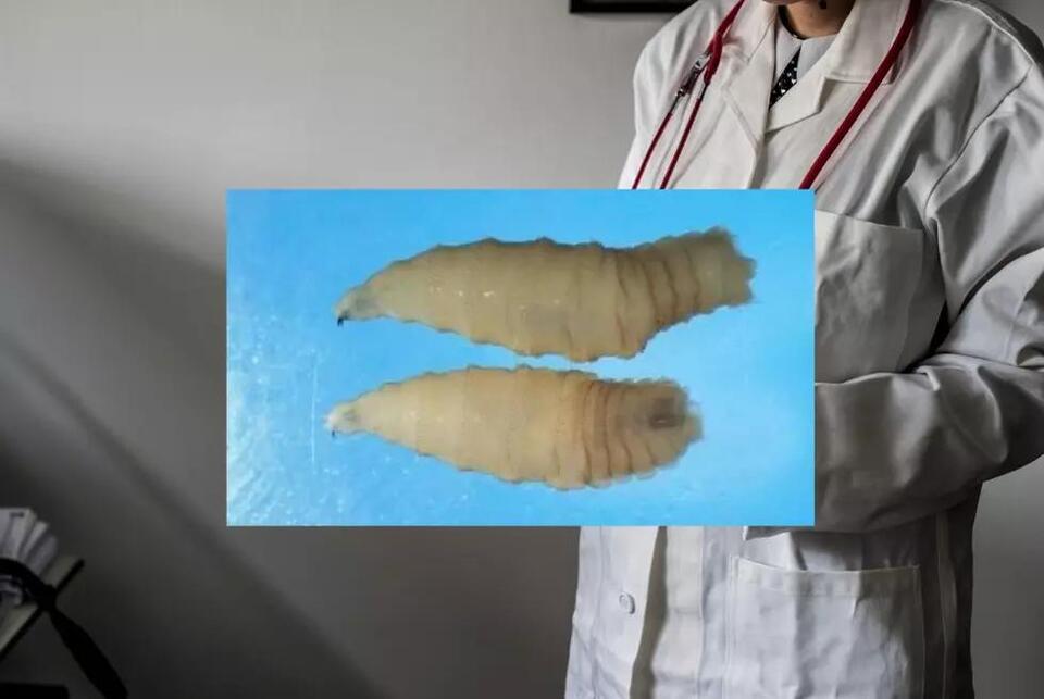 Officials Warn Parasitic Screw Worm Discovered In Mexico Could Move ...