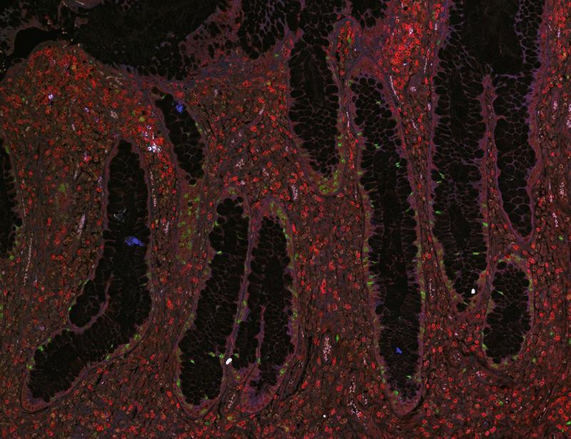 Heterogeneity of the intestinal mononuclear phagocyte compartment in ...