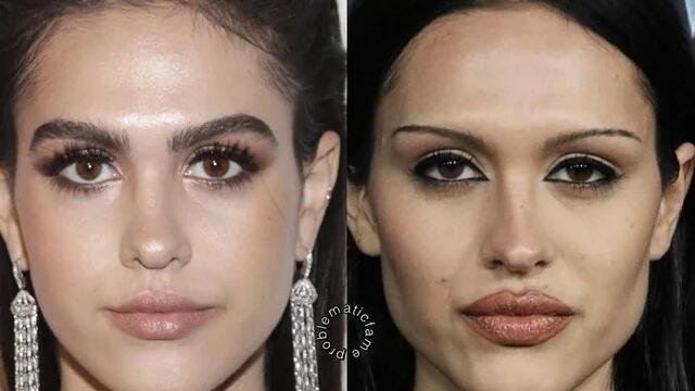 Celebrities who went too far with Plastic Surgery/ Cosmetic Procedure ...