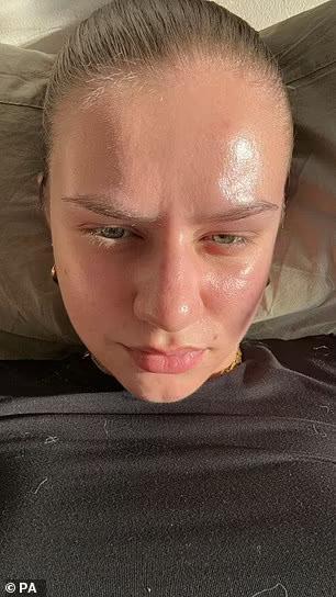 How unsightly acne could be banished with drug store treatment that ...