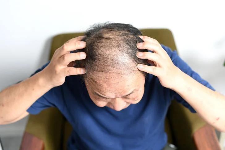 Comb-Overs: What Men Think of Them (& What Hairstylists Say To Do ...