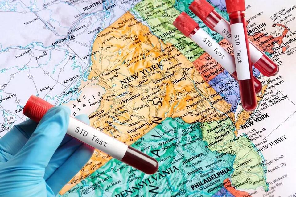 Which New York City Has The Highest STD Rates In The State? - NewsBreak