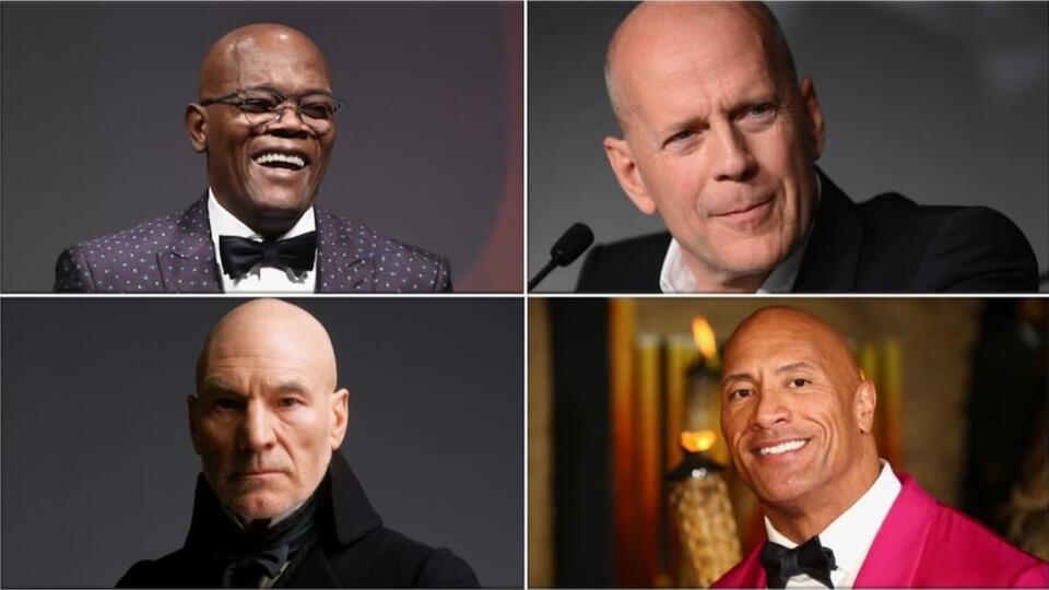 The Bald Truth of Hollywood: No Hair or Fake Hair Never Prevented These ...