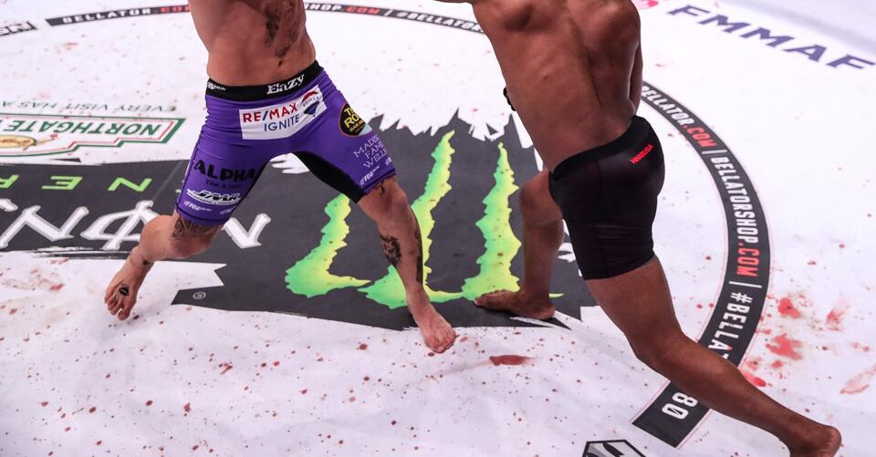 An MMA fighter posted X-rays that showed he suffered a broken jaw and ...