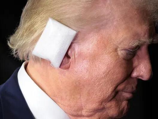Plastic surgeon reveals $10,000 surgery Donald Trump would have to ...