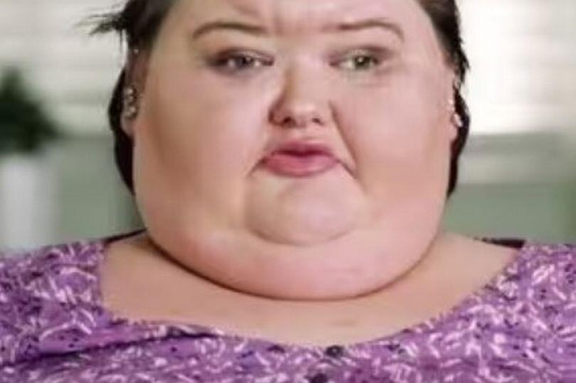 1000-lb Sisters' Amy Slaton 'camel bite' injuries shown in gruesome ...