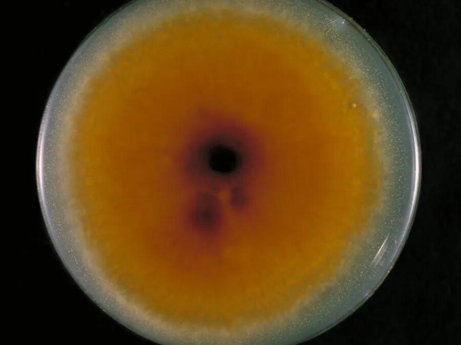 First case of rare, sexually transmitted form of ringworm reported in ...