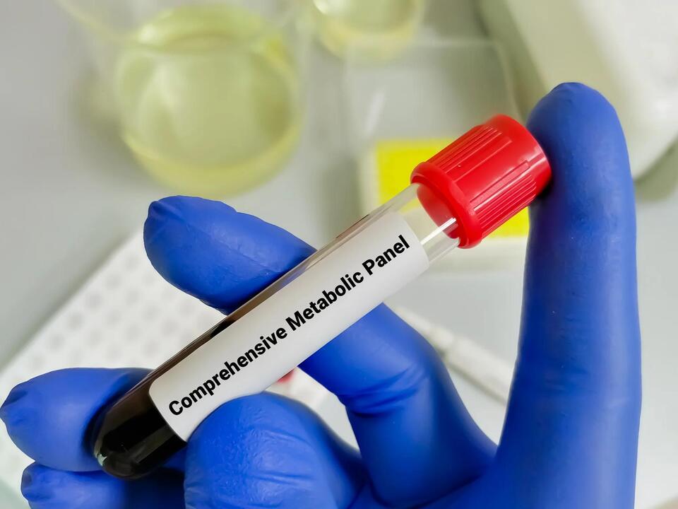 Why “normal range” doesn’t always mean healthy on your lab results ...