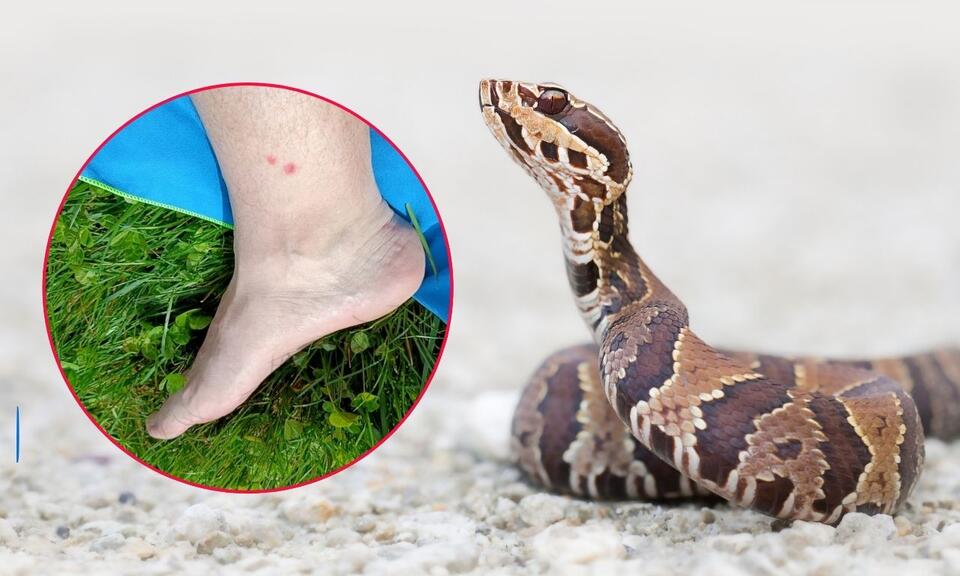 A snake bite can become fatal within hours, here is what experts say ...