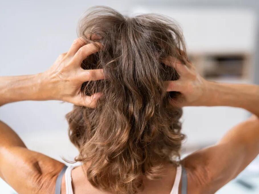 How Much Hair Loss Is Normal? Experts Reveal How To Stop Excessive Hair ...