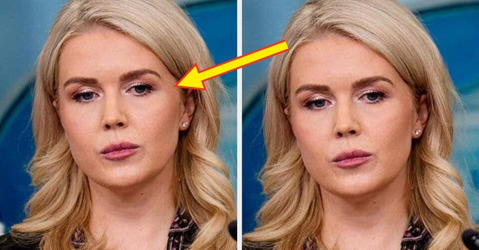 Karoline Leavitt Is Still Refusing To Say Why Trump Recently Had An MRI ...