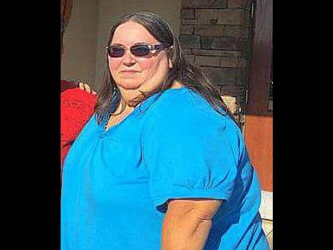 Debbie lost 200 pounds despite a family history of obesity Debbie lost 200 pounds despite a family history of obesity