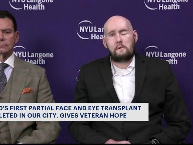 First full-eye and face transplant performed in NYC