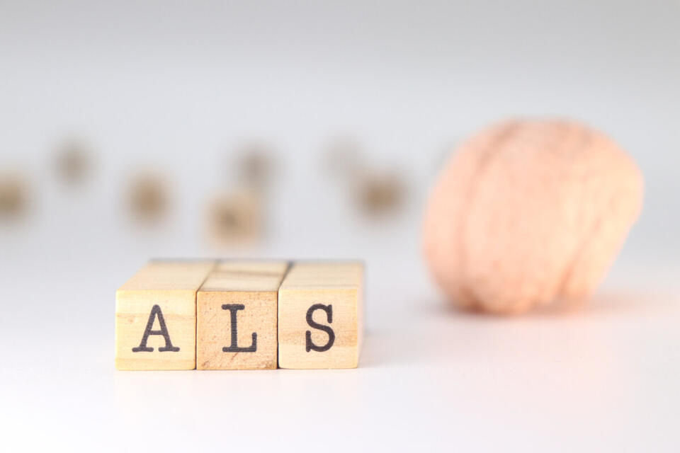Is ALS Written In Your Hair? Researchers Say The Evidence Is Growing ...