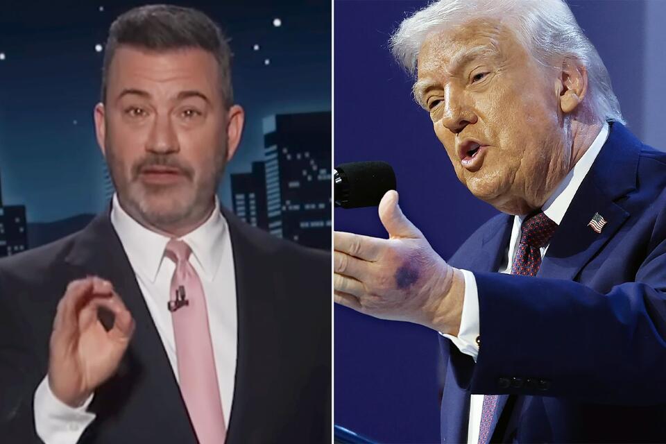 Jimmy Kimmel interviews Trump's badly bruised body part in unhinged ...