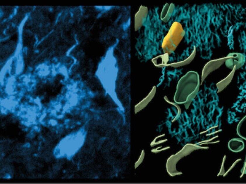 Groundbreaking study reveals what Alzheimer’s disease looks like inside ...