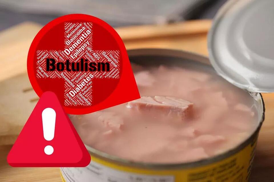 Canned Tuna Sold in New York Recalled over Botulism Contamination ...