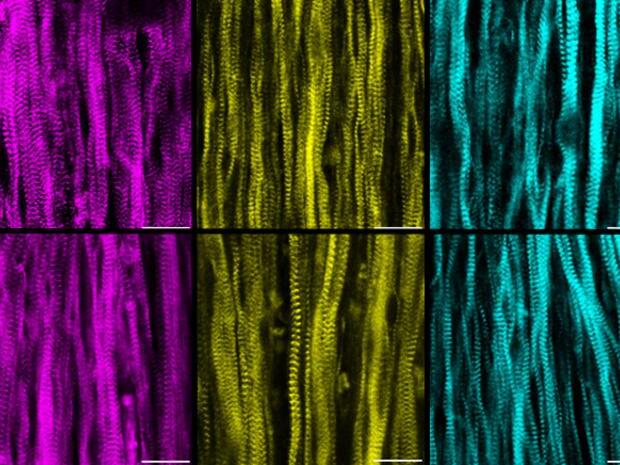 Lab-grown muscles reveal mysteries of rare muscle diseases