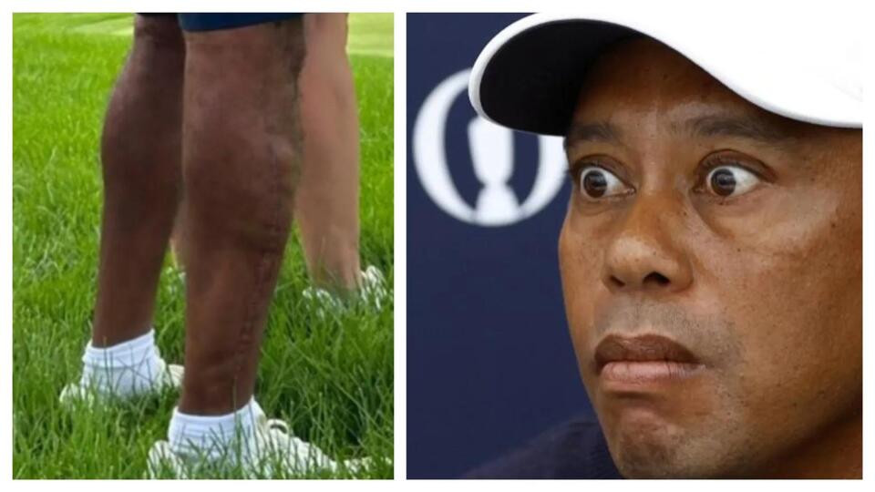 Fans horrified as Tiger Woods' leg pictured without sleeve on for first ...