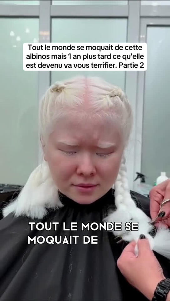 Tout le monde se moquait de cette albinos mais 1 an plus tard ce quelle ...